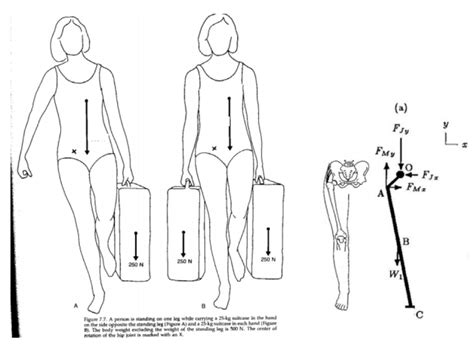 Solved A Find The Joint Reaction Force R And The Abductor