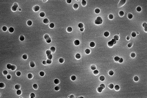 Particle Size Analysis MicroVision Labs