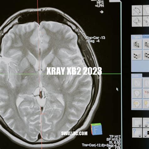 Xray XB2 2023 The Ultimate Off Road Buggy