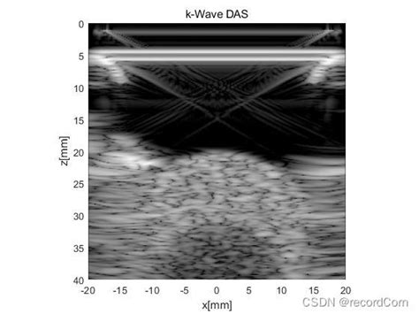 人体组织平面波超声成像仿真matlab K Wave仿真wave3000超声仿真 Csdn博客 人体组织平面波超声成像仿真matlab K Wave仿真wave3000超声仿真 Csdn博客
