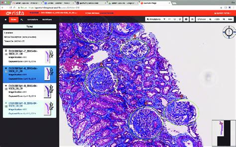 an example of glomerulus annotation pathologists circled individual