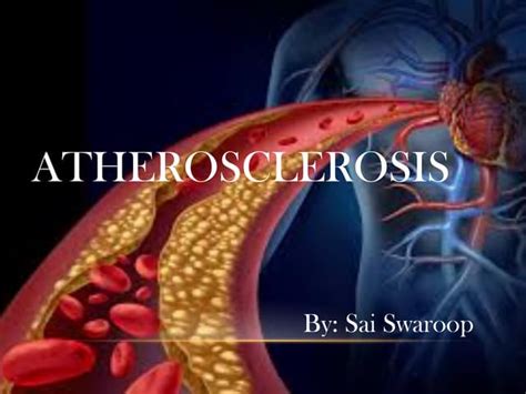 Atherosclerosis Ppt