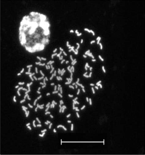 Chromosome Count Analysis On Metaphase Spreads Of One G Kola
