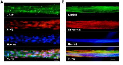 Figure 2 From Chitosansilk Fibroin Based Schwann Cell Derived