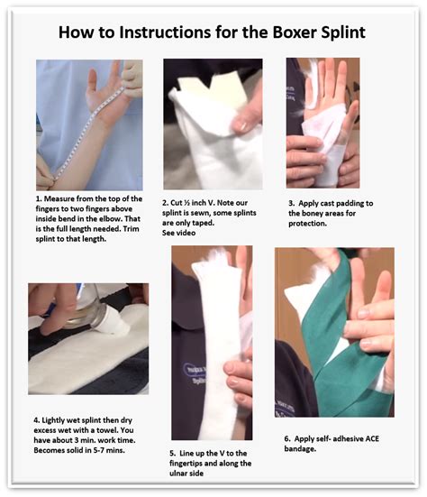 Ulnar Gutter Splint