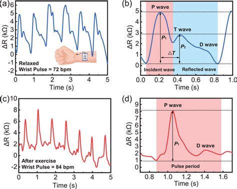 A Pulse Signals Recorded At A Relaxed Status B Enlarged Pulse Signal