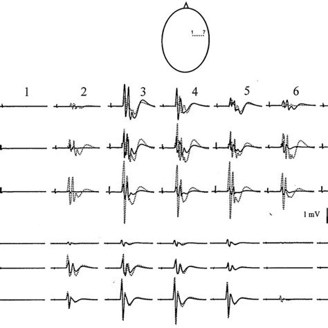 A Example Of A Mep Input Output Curve Obtained In 1 Subject During Download Scientific Diagram