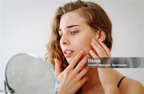 거울을 보고 손으로 얼굴을 만지는 아름다운 여성이 여드름 색소 침착을 검사합니다 가정 생활에 대한 스톡 사진 및 기타 이미지 가정 생활 가정의 방 거울 Istock