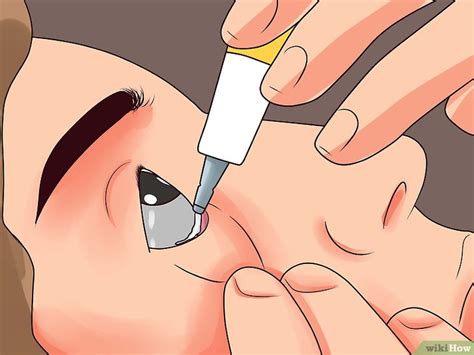 Come Usare Una Pomata Oftalmica Con Eritromicina