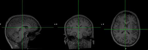 Fmriprep Error No Functional Output Folder Software Support Neurostars