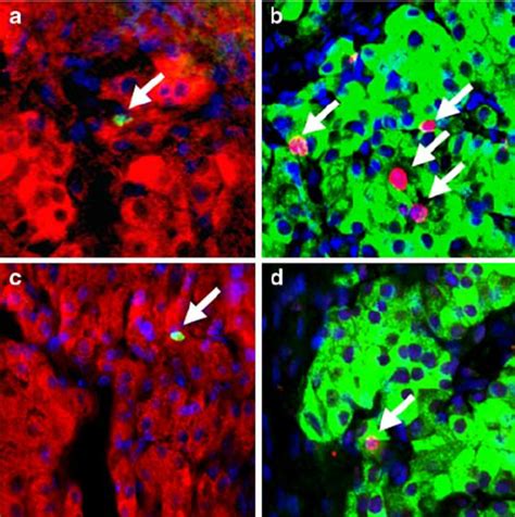 Staining Of Apoptotic And Replicating Beta Cells With Tunel A C Download Scientific