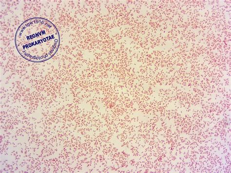 Regnum Prokaryotae Microscope Images