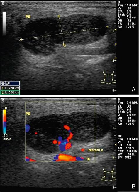 Salivary Gland Imaging Clinical Tree