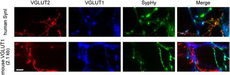 Specificity Of The Vglut1 Promoter For Excitatory Neurons Expressing