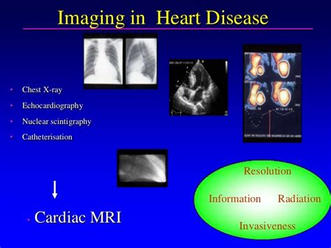 Cardiac Mri