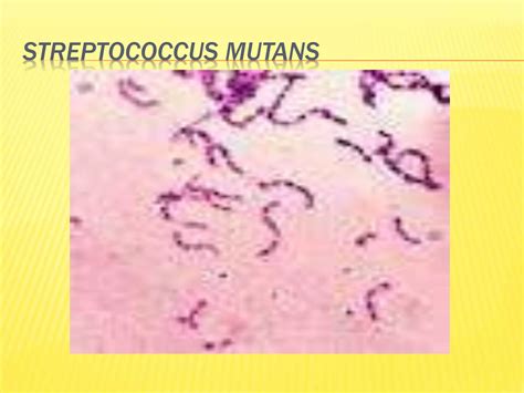 Streptococcus Pptx Ear Nose And Throat Conditions Diseases And Conditions Streptococcus Pptx Ear Nose And Throat Conditions Diseases And Conditions