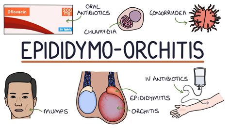 Understanding Epididymo Orchitis Youtube