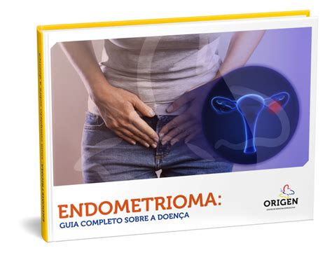Endometrioma Guia Completo Sobre A Doença Clínica Origen