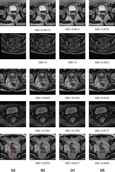 Visualization Of The Segmentation Results Of Each Model A Ground Download Scientific Diagram
