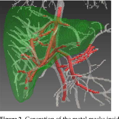 Figure 2 From End To End Deep Learning Ct Image Reconstruction For