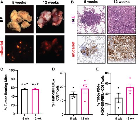 Tracking Tumor Immune Interactions In Tumors From Transplanted Download Scientific Diagram