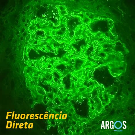 Na Imunofluorescência Direta Um Anticorpo Quimicamente Ligado Ao