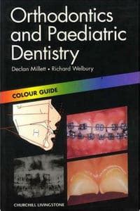 MEAW Multi Loop Edgewise Archwire Orthodontic Treatment With MEAW