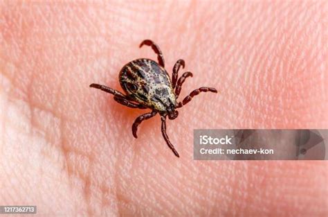 보렐리아 감염 진드기 곤충 피부에 크롤링 뇌염 바이러스 또는 라임 보렐리아 질환 감염성 피부초초진드기 진드기 거미류 기생충 0