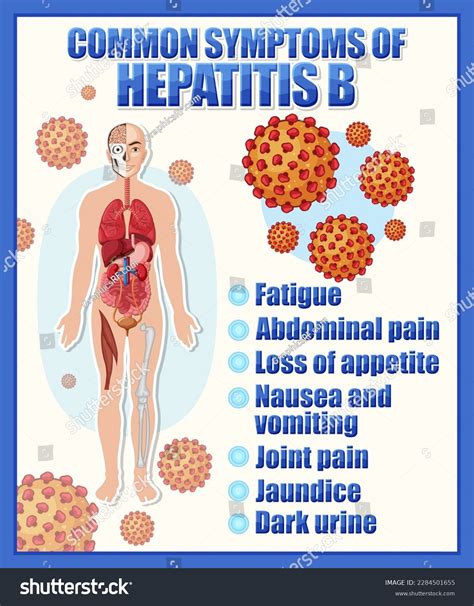 Informative Poster Common Symptoms Hepatitis B Stock Vector Royalty