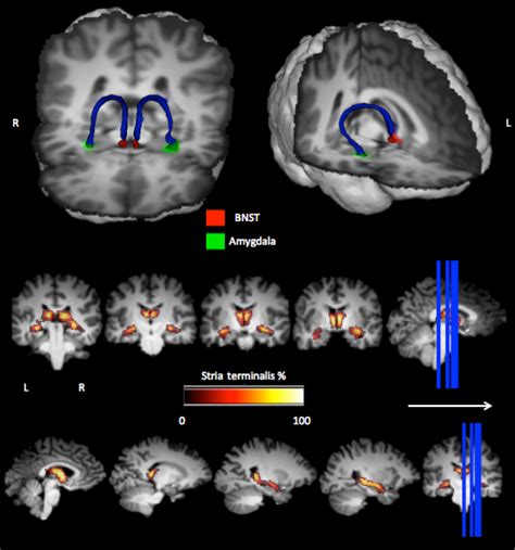 Stria Terminalis Anatomy