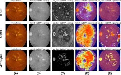 The Performance Of Different Models Such As U‐net Segnet Mrt‐segnet Download Scientific
