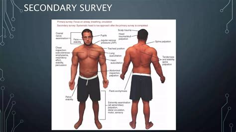 ATLS Guidelines Pptx