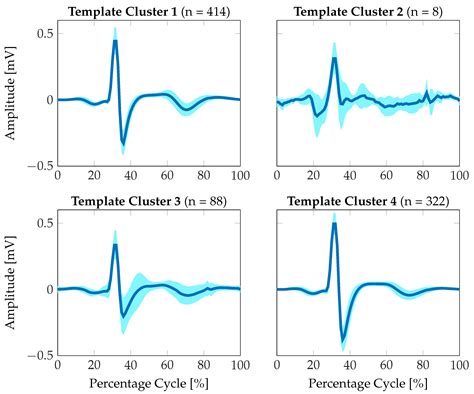 Automated Signal Quality Assessment Of Single Lead Ecg Recordings For Early Detection Of Silent