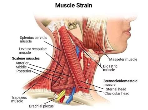 What Neck Pain On The Left Side Means Njs Top Orthopedic Spine
