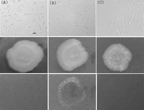 Pseudohyphal And Invasive Growth Of S Pombe Ncyc132 Yeast Were Grown Download High