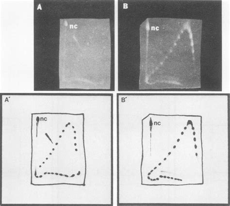 Two Dimensional Gel Analysis Of Z Dna Formation In Plasmids Containing