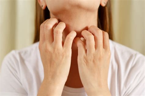 Codeine Allergy Learn About Symptoms And Management