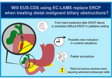 Will Endoscopic Ultrasound Guided Choledocoduodenostomy With