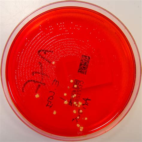 Xld Agar Shigella Xld Agar For The Isolation Of Salmonella And
