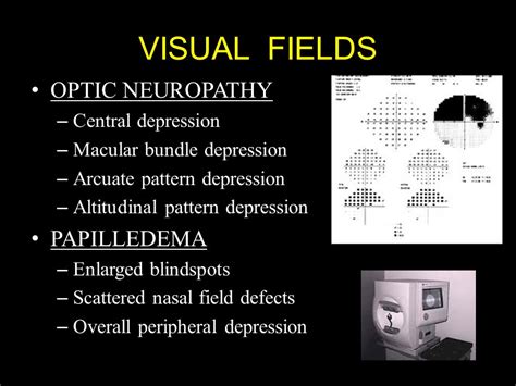 Sleuthing The Swollen Optic Disk Ppt Download