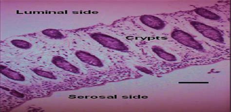 The Effects Of Amiloride And Age On Oxygen Consumption Coupl Saudi Journal Of Gastroenterology
