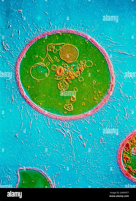 False Colour Transmission Electron Micrograph Tem Of Cryptococcus