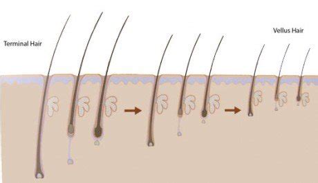 What Is Terminal Hair Hair Transplant Mentor