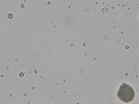 Exploring Lallemands Torula Yeast Specialties Savory Ingredients