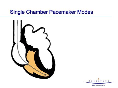 Ppt Nbg Pacemaker Code Powerpoint Presentation Free Download Id
