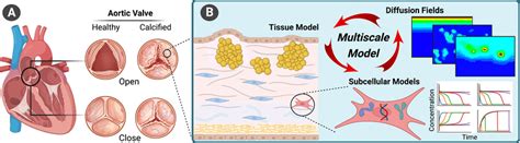 A Schematic Comparison Between A Healthy Aortic Valve And A Calcified Download Scientific