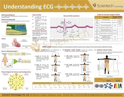 Understanding ECG Ecg Pinterest