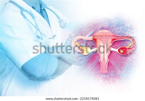 Doctor Check Diagnose Female Reproductive System Stock Illustration Shutterstock