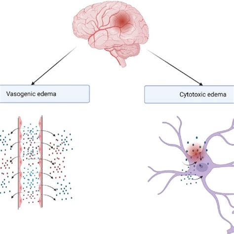 Pathophysiological Overview Of Vasogenic Or Cytotoxic Edema Download
