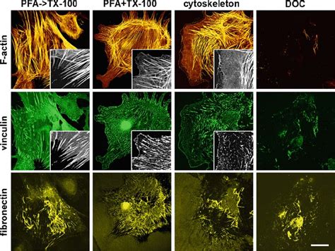 3 Different Permeabilization Procedures In Combination With Pfa